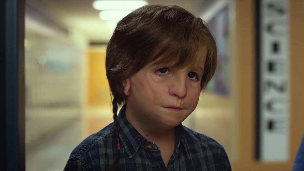 Wonder: Jacob Tremblay On His Prosthetic