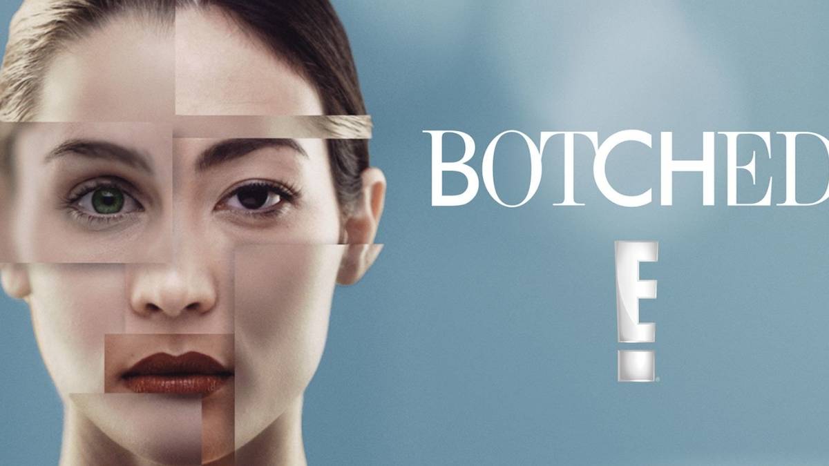 Botched Patient Reveals She Has Two Implants in Each Breast
