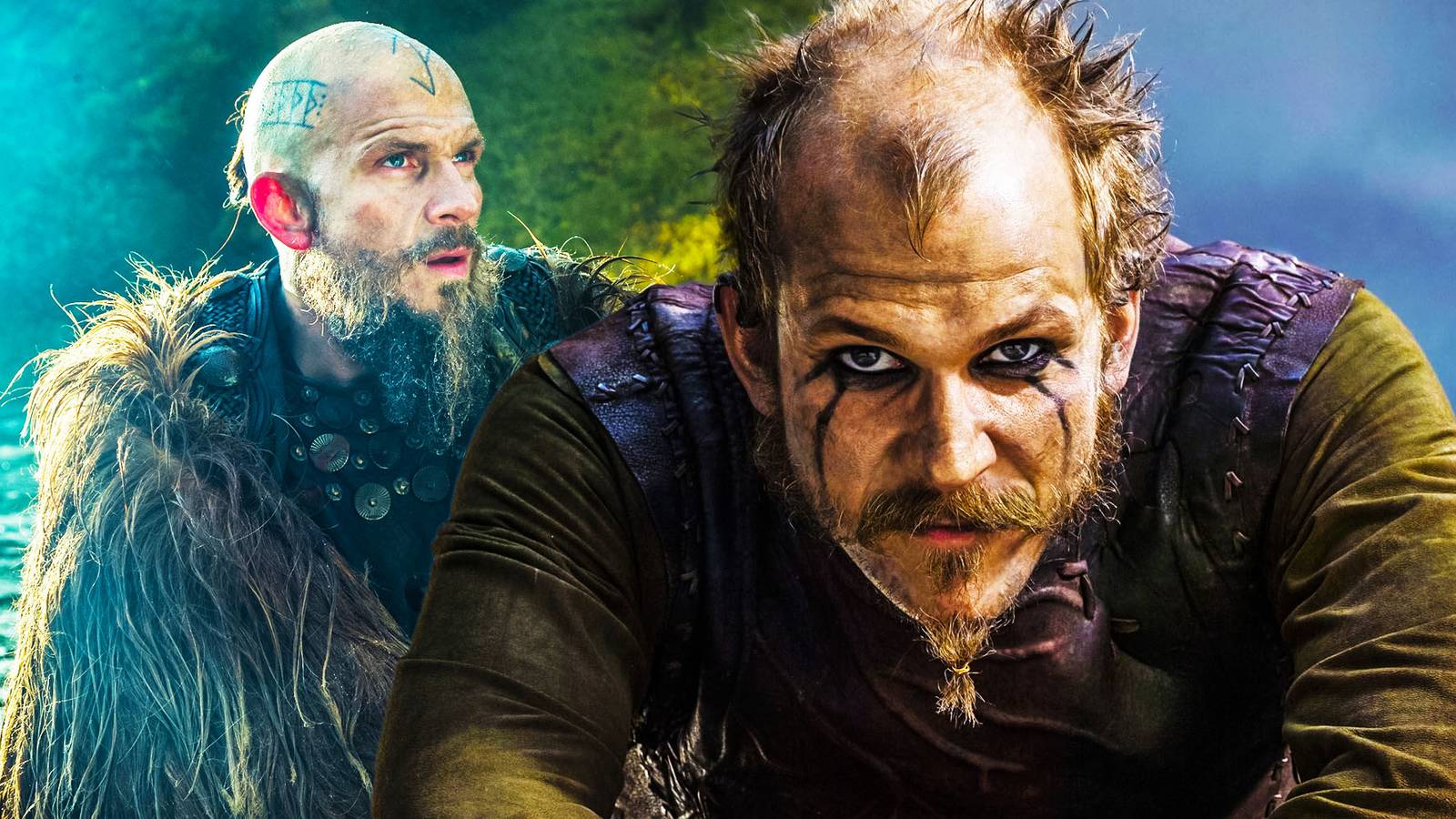 What Condition Did Floki Have In Vikings?