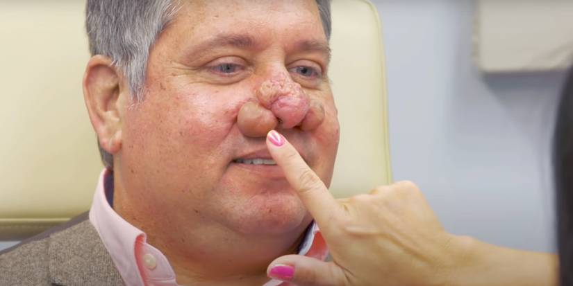 Dr Pimple Popper: Dr. Lee's 10 Biggest Pops
