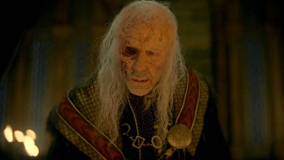 How HOTD’s VFX Team Made Viserys’ Diseased Face Look So Realistic