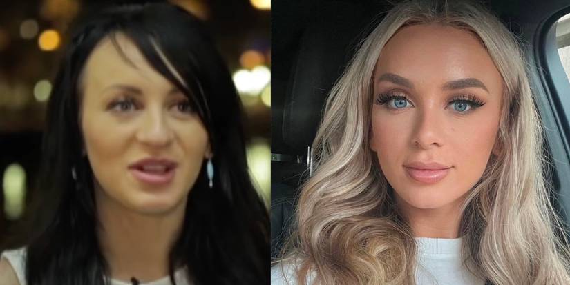 How 90 Day Fiancé's Yara's Face Changed After Plastic Surgery Makeover