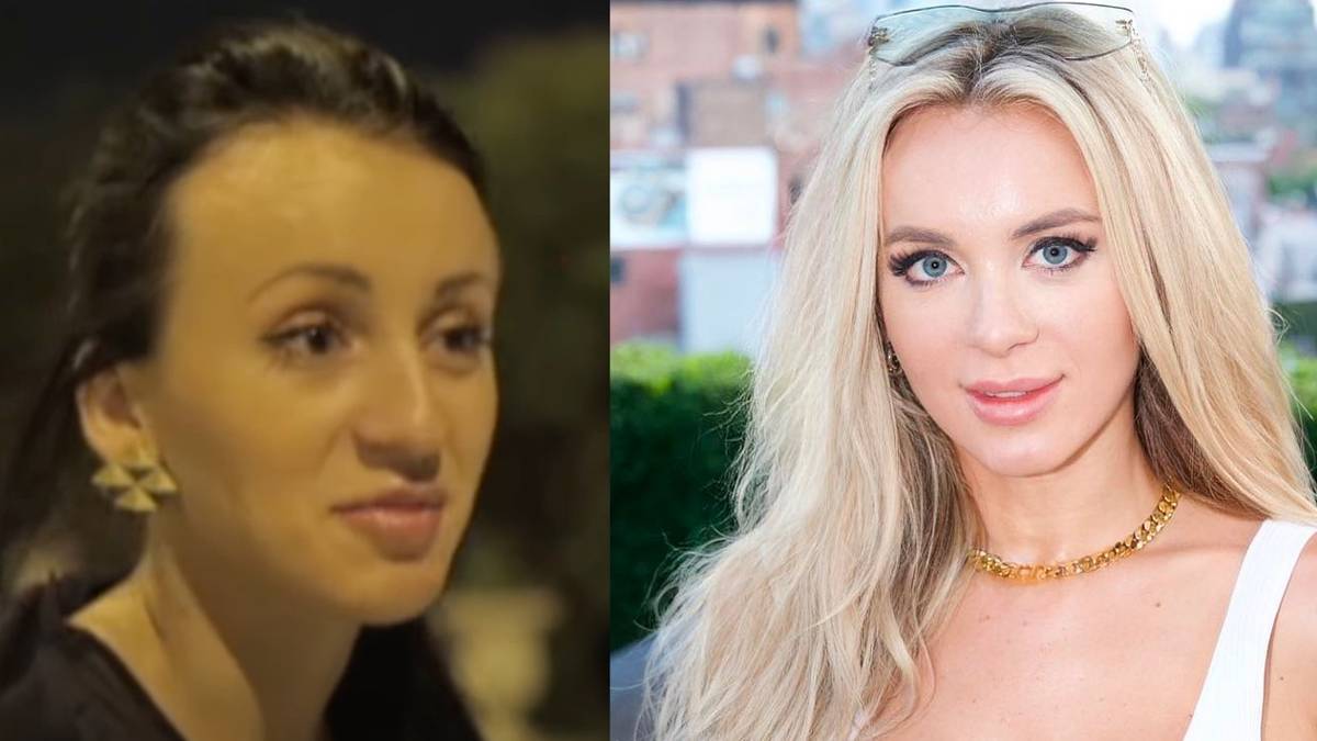 How 90 Day Fiancé's Yara's Face Changed After Plastic Surgery Makeover