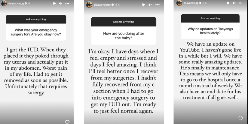 90 Day Fiancé’s Deavan Reveals Why She Underwent Emergency Surgery