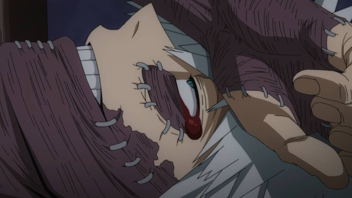 My Hero Academia Proves Dabi Cares About One Todoroki, Only in Japanese