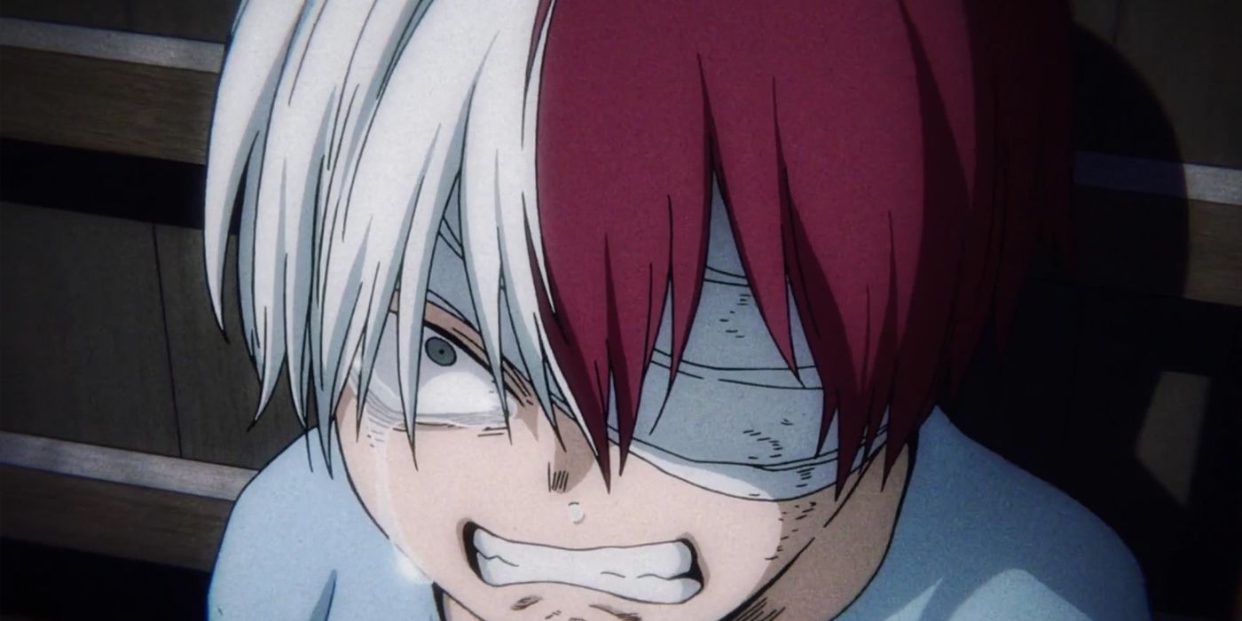 How Did My Hero Academia's Todoroki Get His Scar?