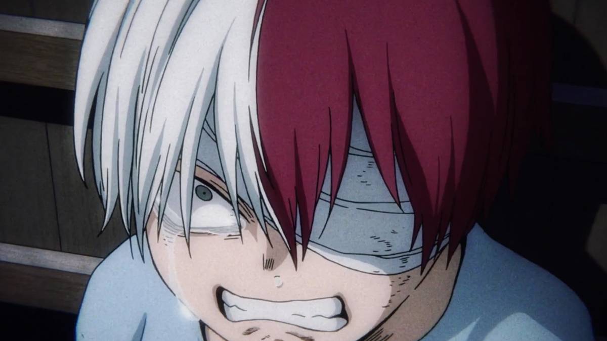 How Did My Hero Academia's Todoroki Get His Scar?