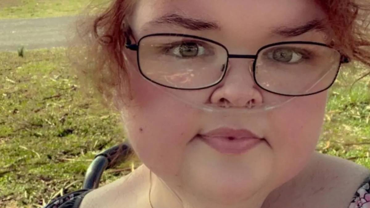 1000-Lb Sisters: How Tammy's Face Changed After 115-Pound Weight Loss