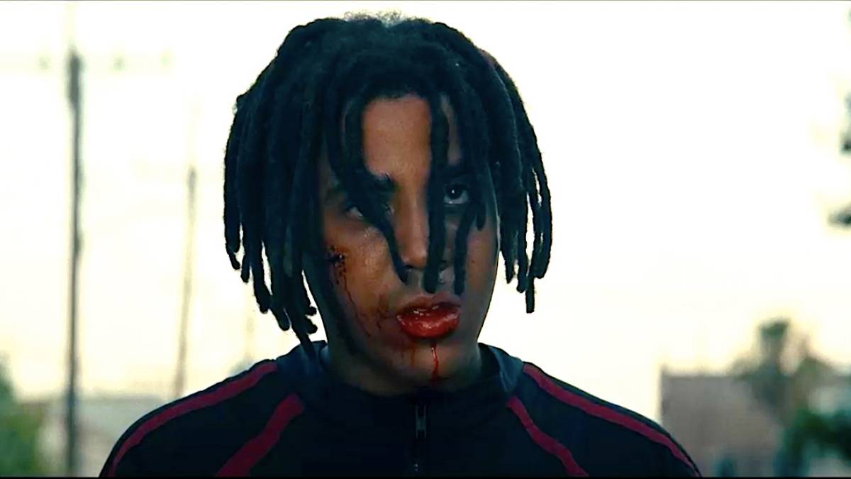 I’m A Virgo Season 2 Update As Star Explains Cootie's Rash