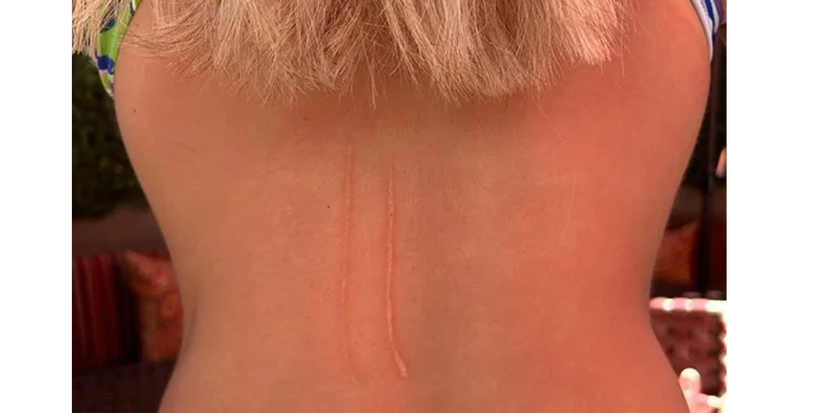 Below Deck Sailing Yacht Season 4- Lucy's Back Injury Update (How It ...