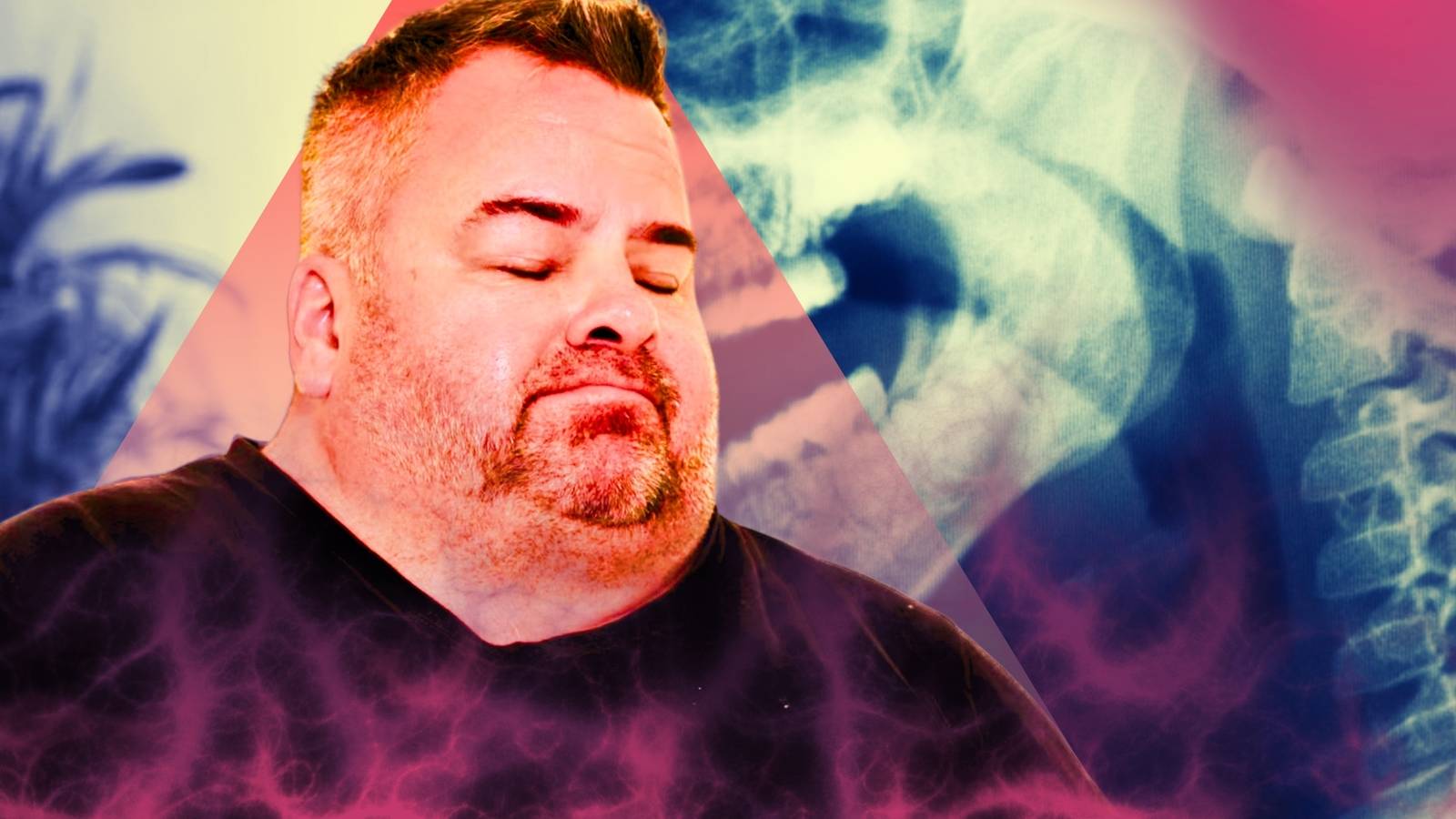 90 Day Fiancé: How Big Ed's Klippel-Feil Syndrome Has Affected Him