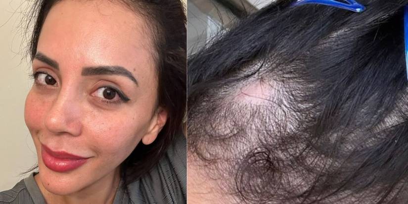 90 Day Fiancé: Jasmine's Alarming Before & After Photos Showing Alopecia Hair Condition