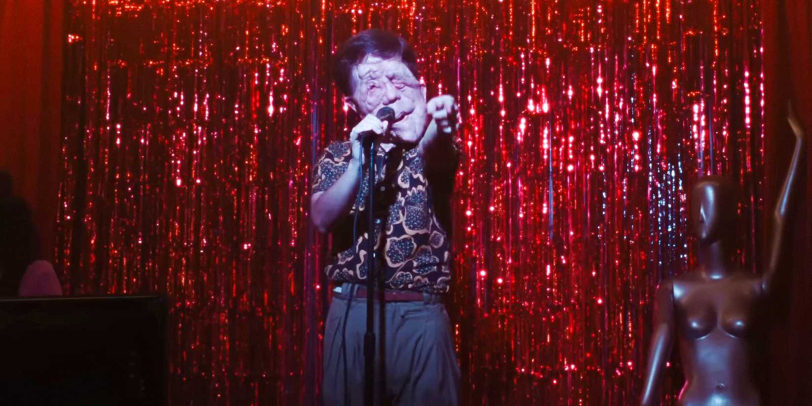 The Elephant Man Remake Lands A Different Man Star In Leading Role