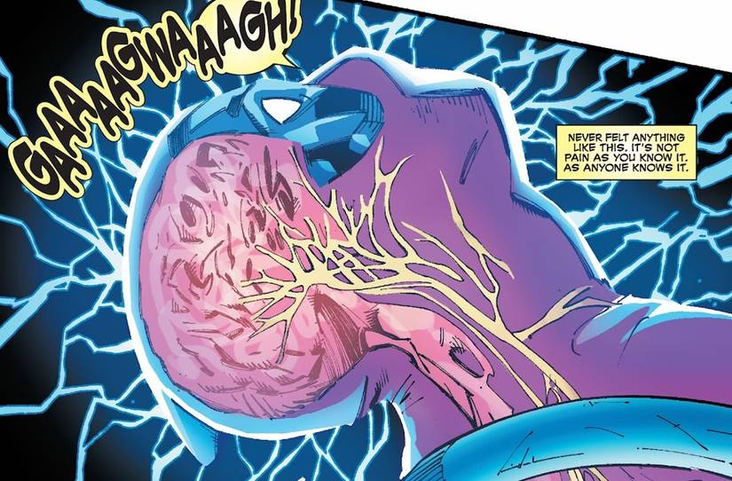 Deadpool Just Officially Lost His Healing Factor in Marvel Lore