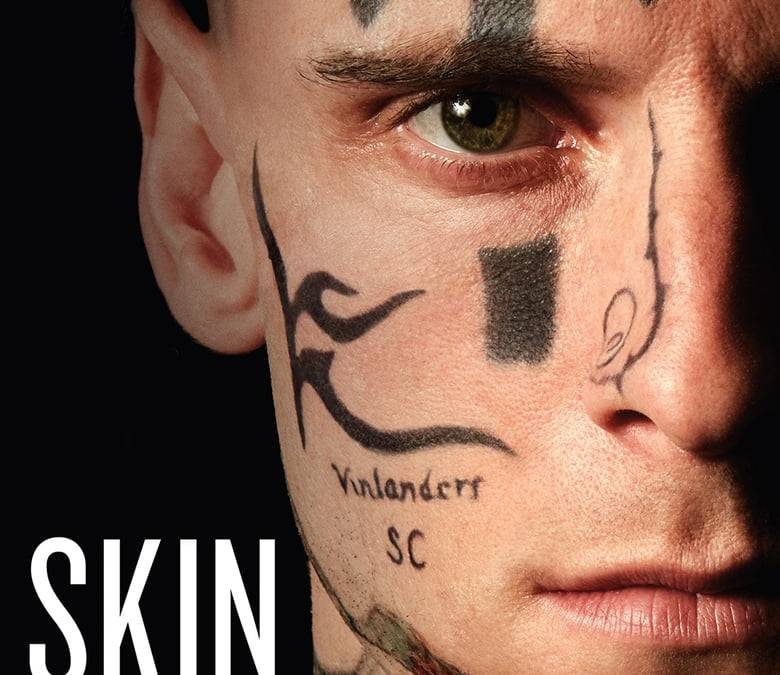 Skin Summary, Trailer, Cast, Where to Watch and More