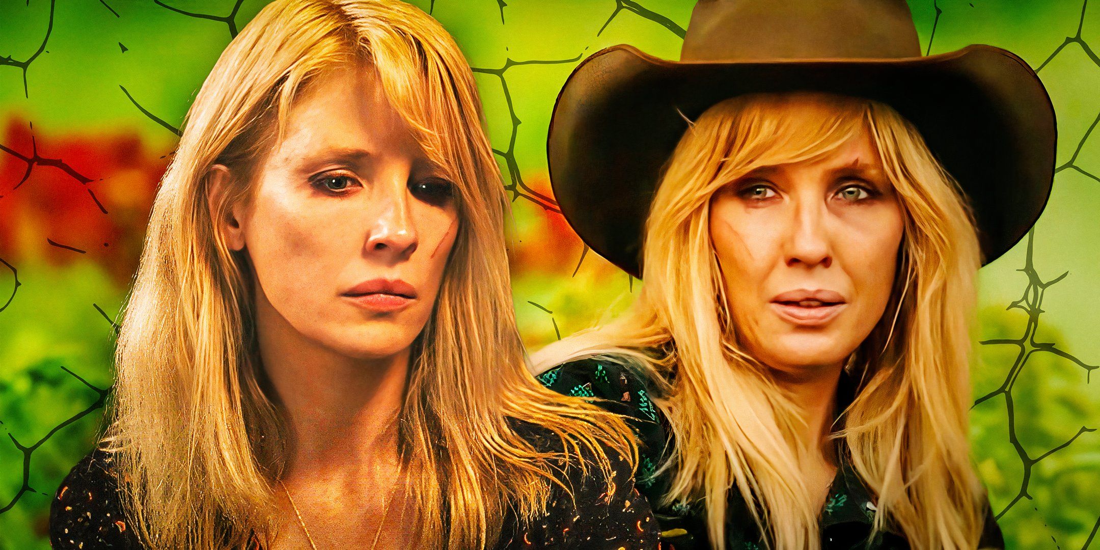 Yellowstone: All Of Beth Dutton's Scars, Explained