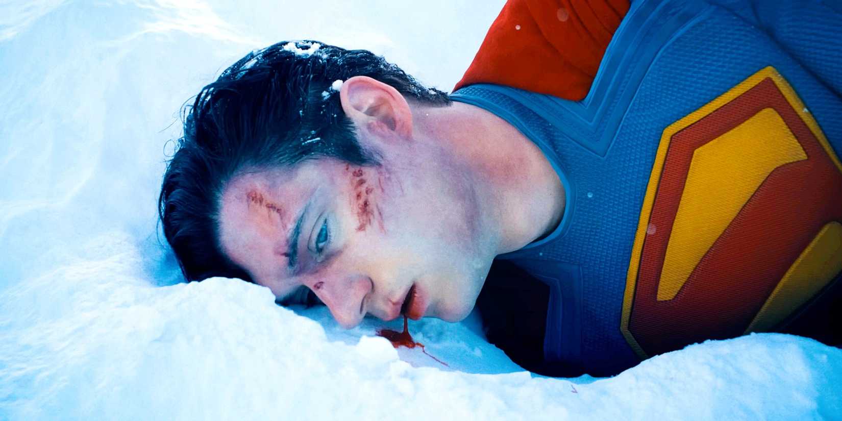 James Gunn Addresses Why Superman Bleeds In The First Shot Of The DC ...