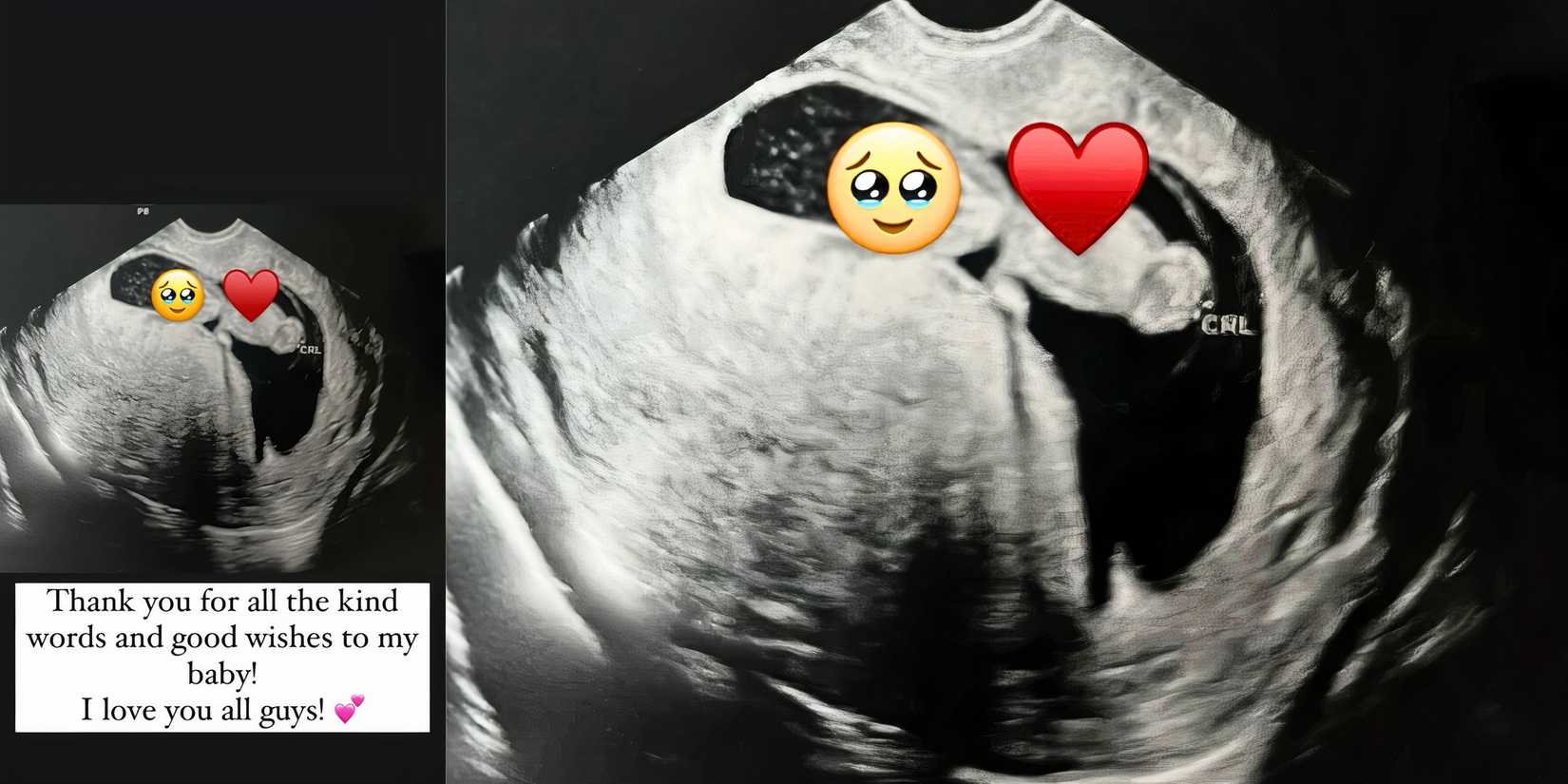 90 Day Fiancé’s Jasmine Pineda Reveals First Photo Of New Baby With ...