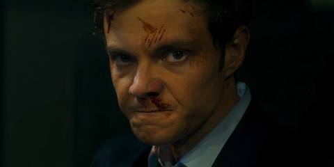 Novocaine Summary, Trailer, Cast, Where to Watch and More